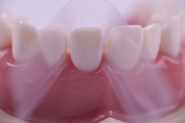 ProxyPal 3D matriisi - Selluloidimatriisit - Hammasväline Oy